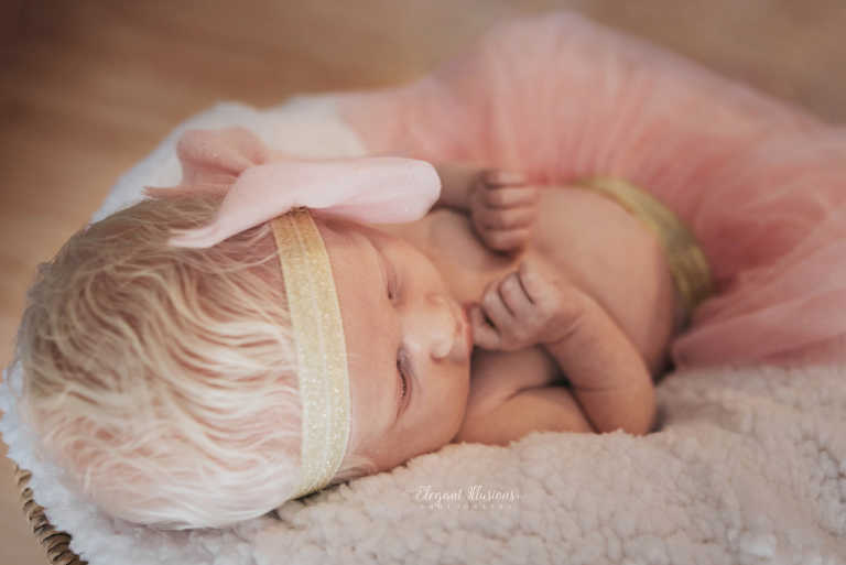 ‘Our baby had a head full of hair — WHITE AS SNOW.’: Mom’s shocked ...