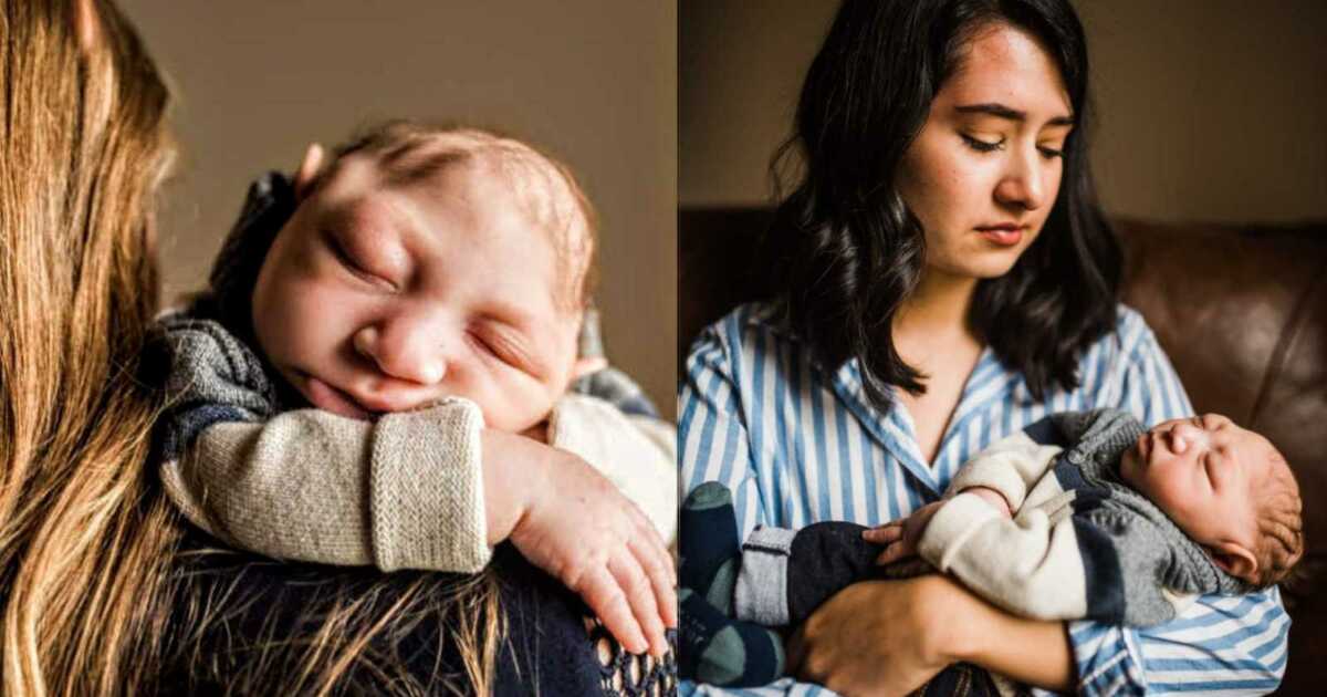 I Photographed This Newborn With Microcephaly A Day Before He Died, And ...