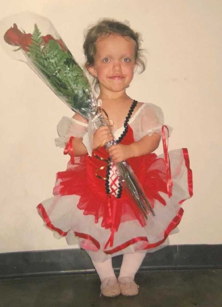 ‘What’s it like being a little person?’ I was touched without my ...