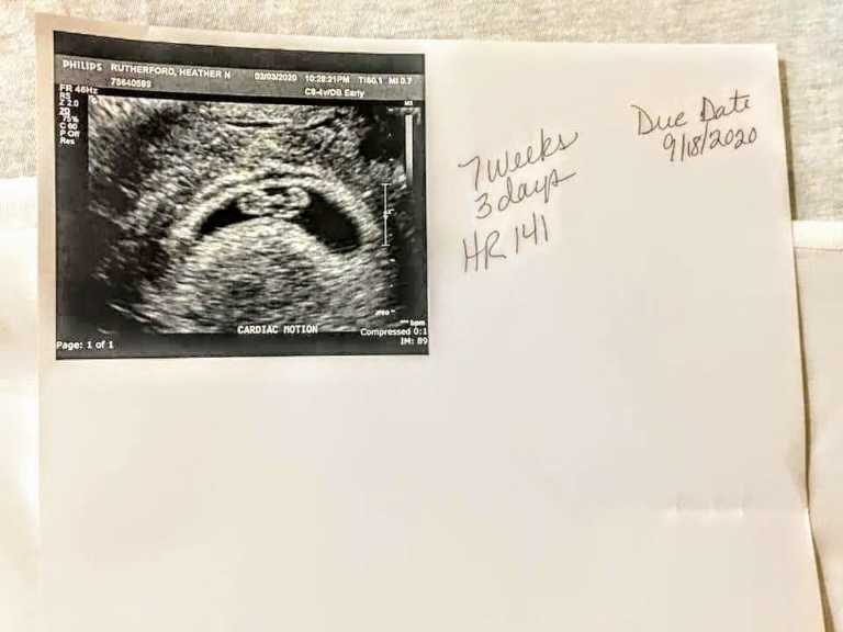 ‘This baby is nothing but a miracle.’ I had no fallopian tubes. They ...